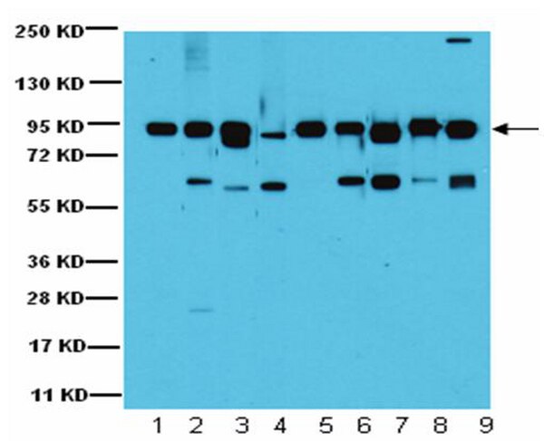 Anti-Glucose Regulating Protein 94 (GRP94) Antibody | 07-1408